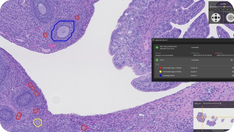 Digital Pathology - Pathexperts